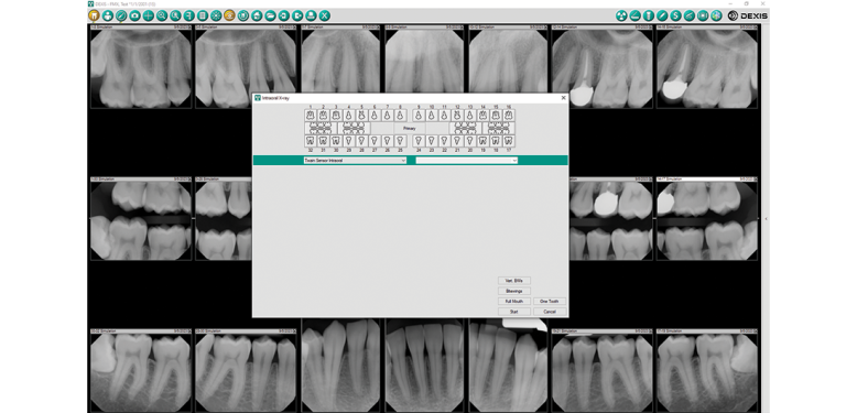 Software DEXIS™ Imaging Suite | DEXIS